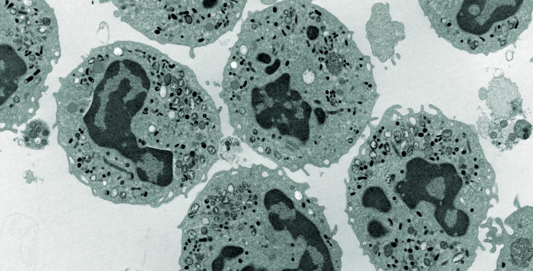 Lisosomas - Qué son, características, funciones y estructura