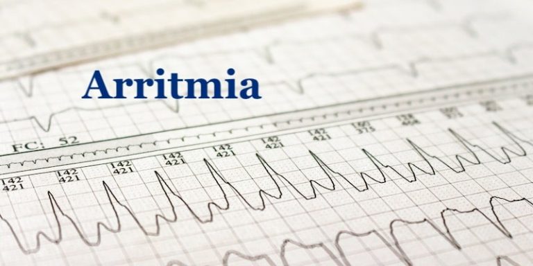 Tecnicismo - Qué es, concepto y ejemplos